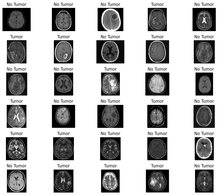 Brain Tumor Detection Using Deep Learning Cnn